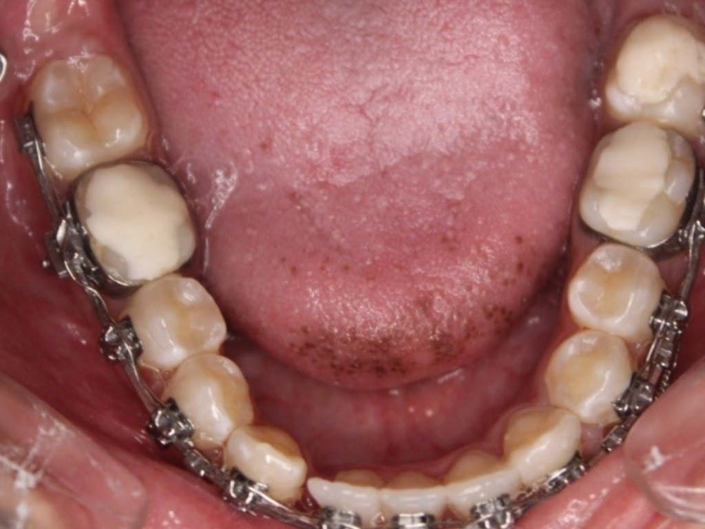 Orthodontics and Dentofacial Orthopedics Unveiled: Crafting Confident ...